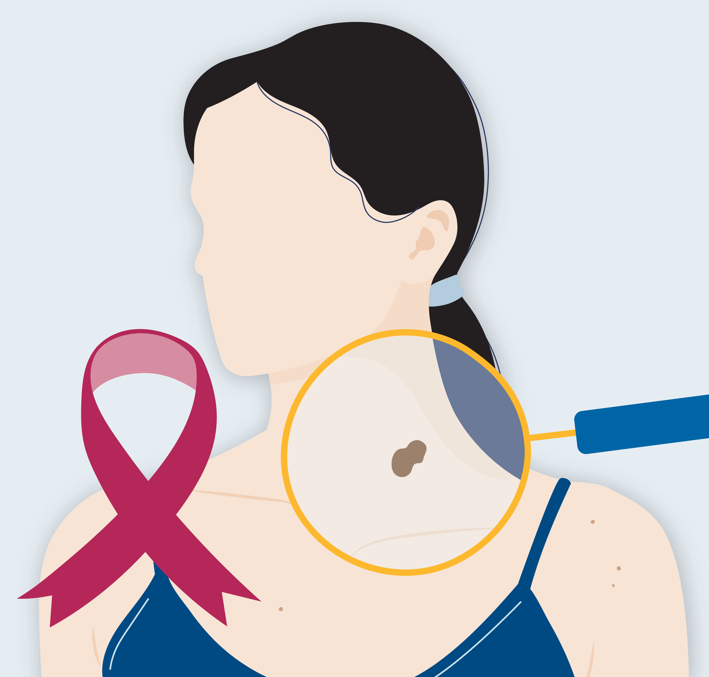 Preventing Skin Cancer - 5 important points to know - HSF Blog