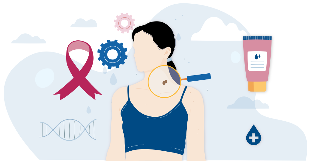 Preventing Skin Cancer - 5 important points to know - HSF Blog